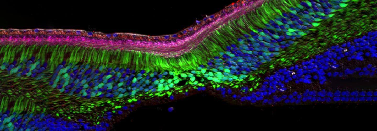 Our Technology - Adverum Biotechnologies