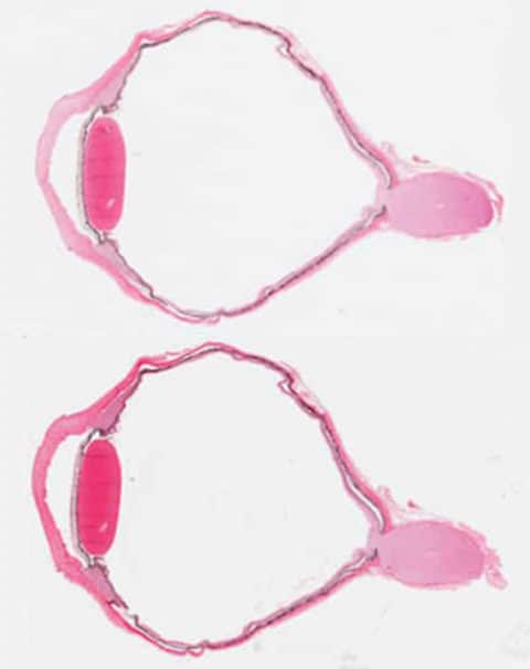 Our Technology - Adverum Biotechnologies